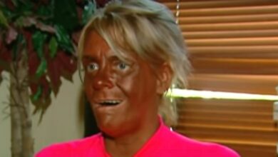 Patricia Krentcil tanned five days a week and almost lost her life ...