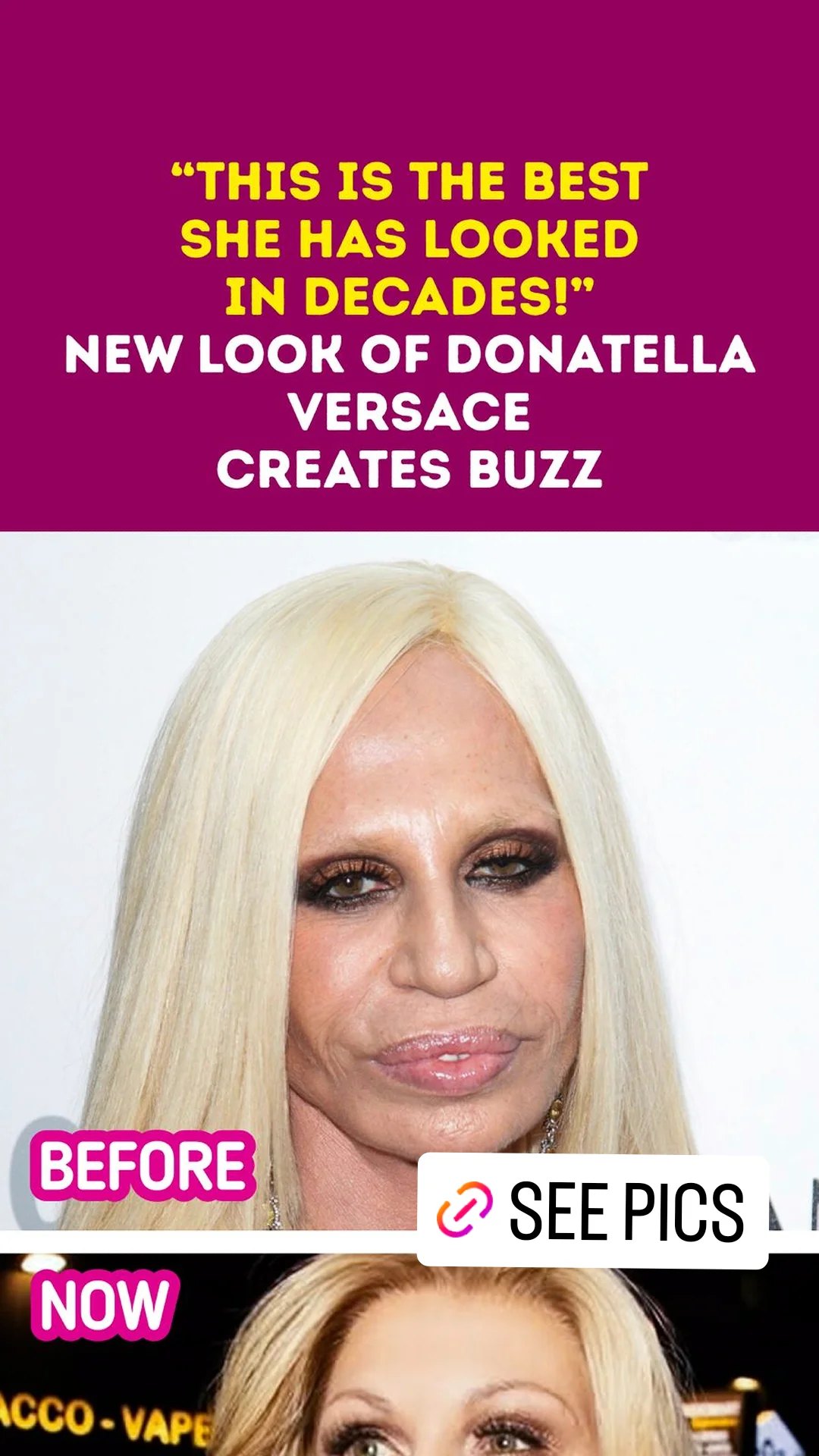 “This Is the Best She Has Looked in Decades!” New Look of Donatella ...